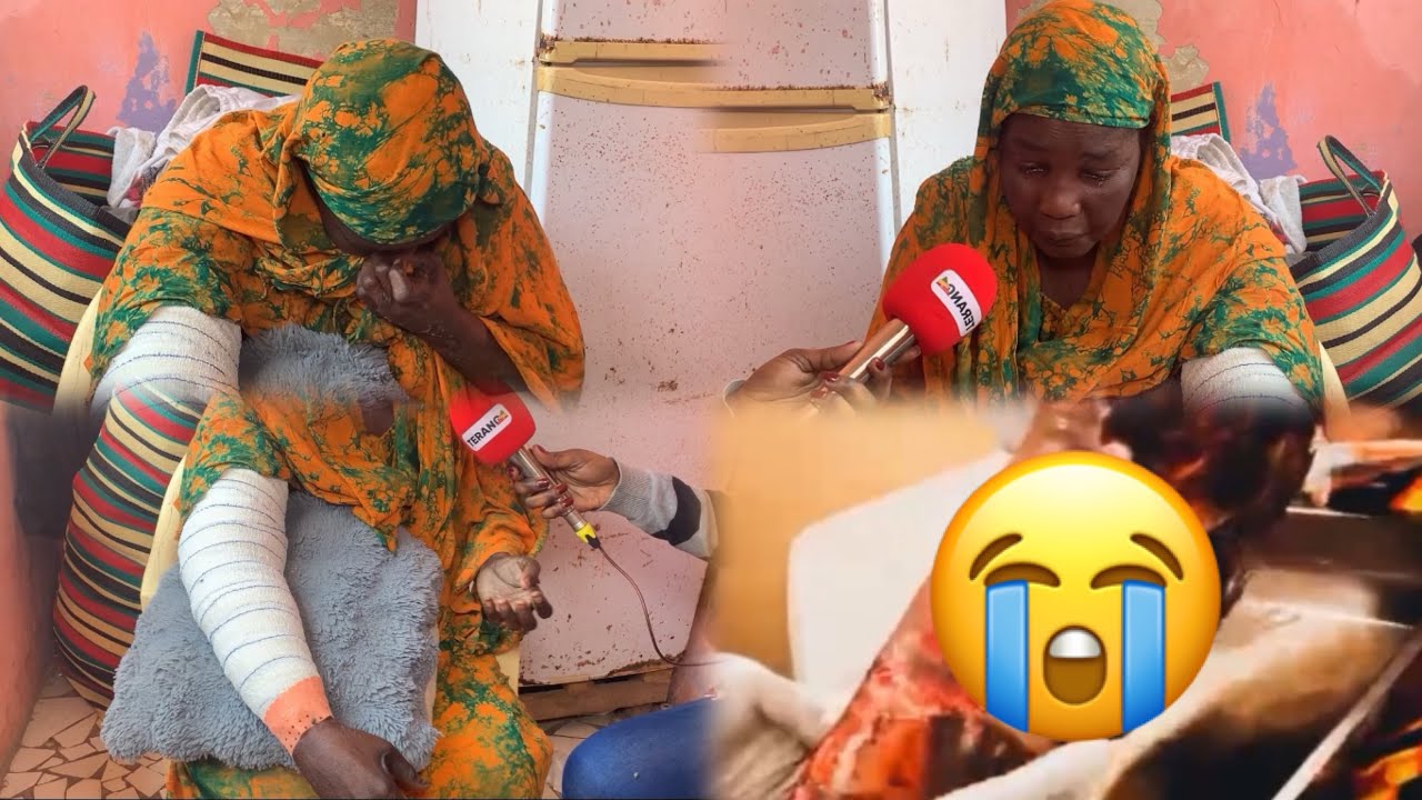 Aspergée d’acide par sa co-épouse : Marème, en larmes et abandonnée par ...
